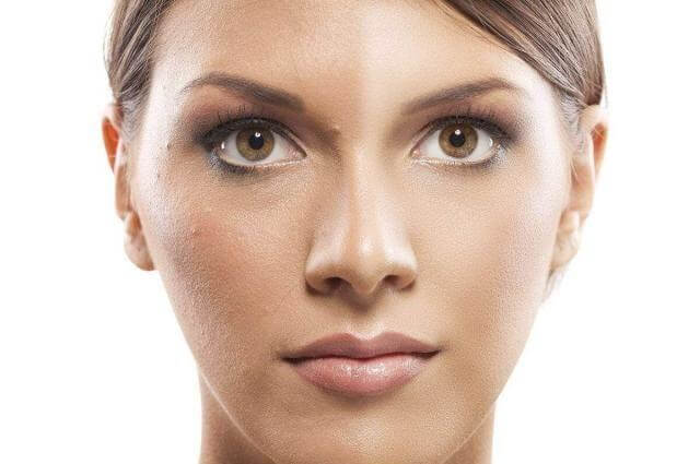 How to Improve Dull Facial Skin? – ANAIRUI